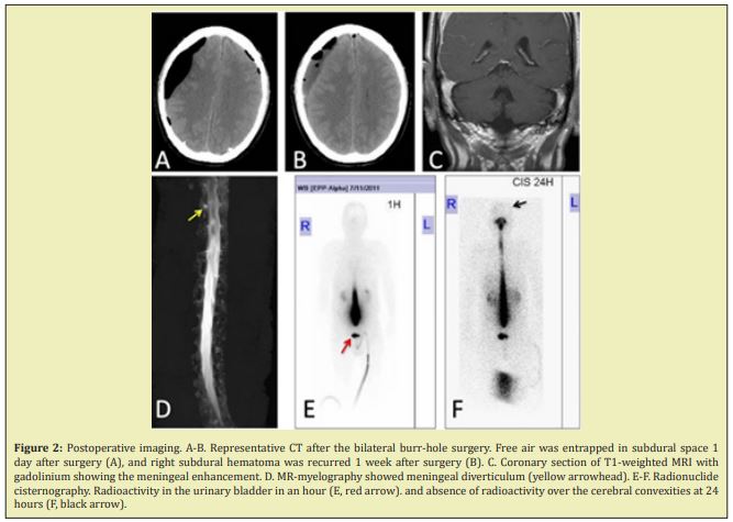 SOJMCCR.MS.ID.000503